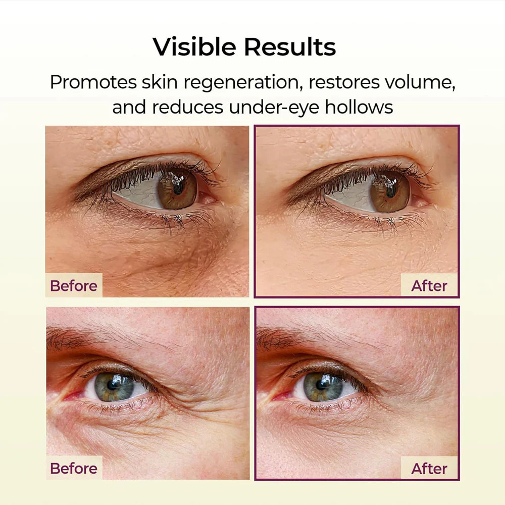 Dr Melaxin - Cemenrete Calcium Volume Multi Balm | Xq